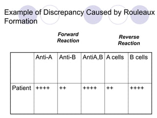 DISCREPANCIES IN ABO GROUPING IN IMMUNOHEMATOLOGY.ppt