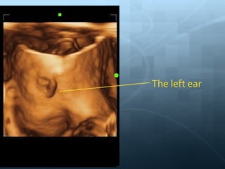 Discrepancy in uterine size | PPT