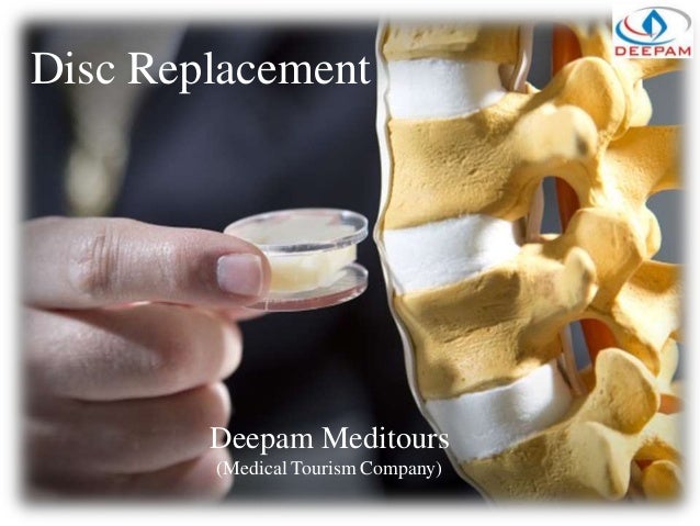 Disc Replacement surgery