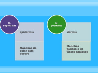 Discromias | PPTX