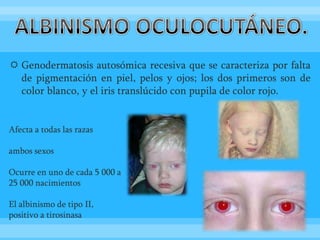 Discromias | PPTX