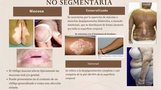 DISCROMIAS. APRENDE A DIFERENCIAR LAS DISCROMIAS | PDF