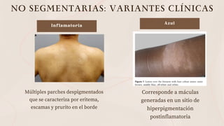 DISCROMIAS. APRENDE A DIFERENCIAR LAS DISCROMIAS | PDF