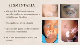 DISCROMIAS. APRENDE A DIFERENCIAR LAS DISCROMIAS | PDF