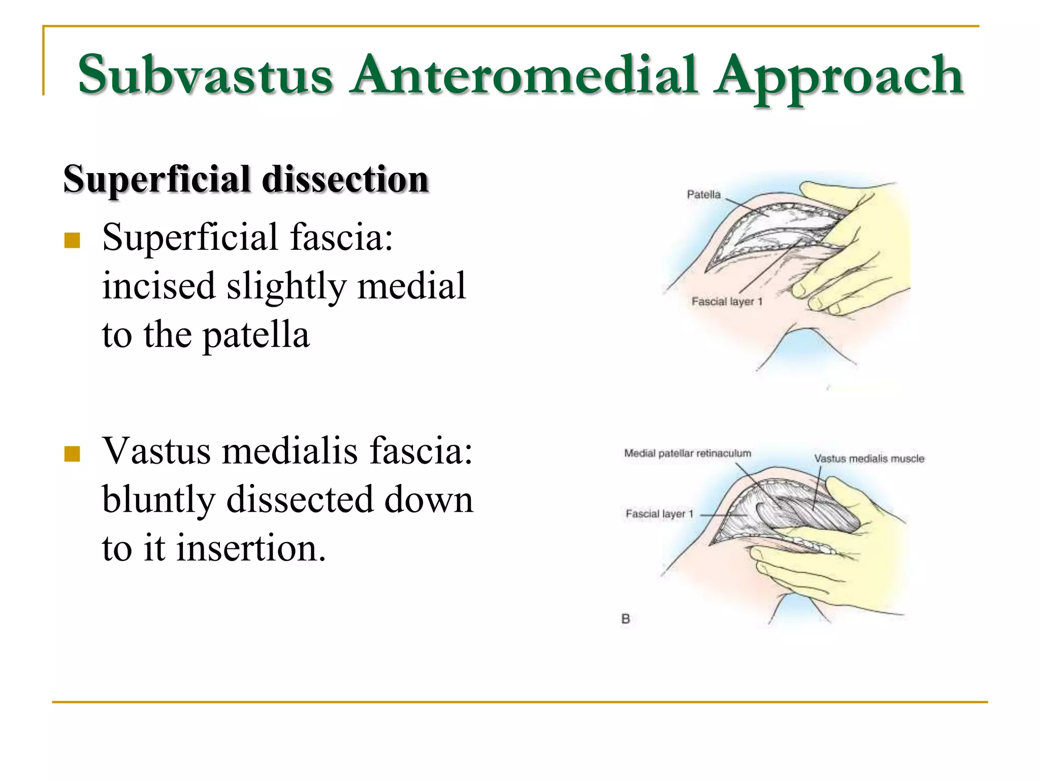 Discuss approaches to the knee and Describe in detail TKR | PPTX