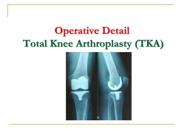 Discuss approaches to the knee and Describe in detail TKR | PPTX ...