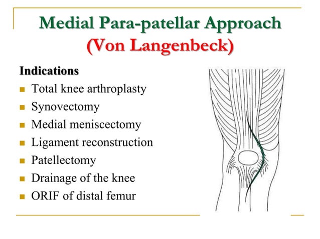 Discuss approaches to the knee and Describe in detail TKR | PPTX ...