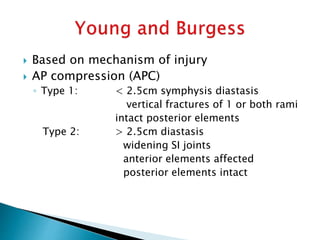 Discuss classifications and management of pelvic injury | PPTX