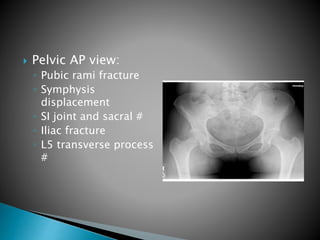 Discuss classifications and management of pelvic injury | PPTX