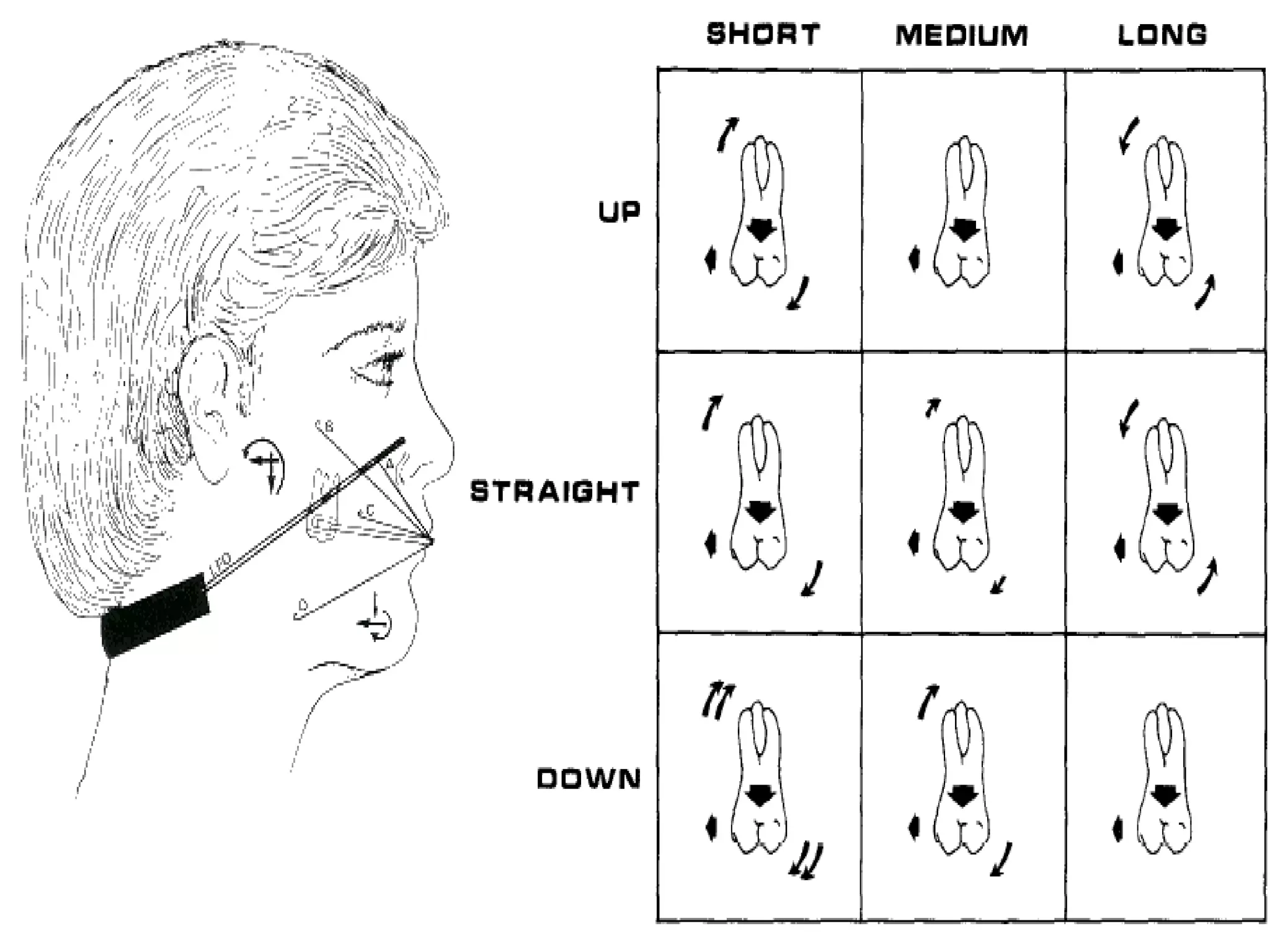 Biomechanics of Headgears | PPTX | Dental Health | Diseases and Conditions