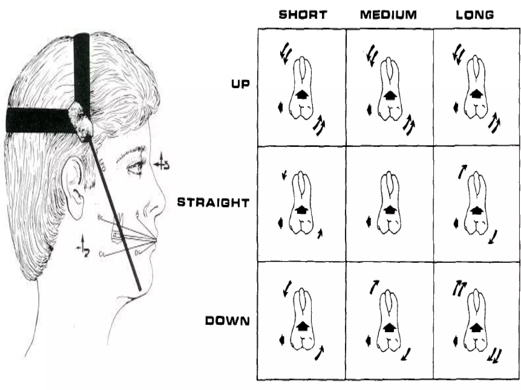 Biomechanics of Headgears | PPTX