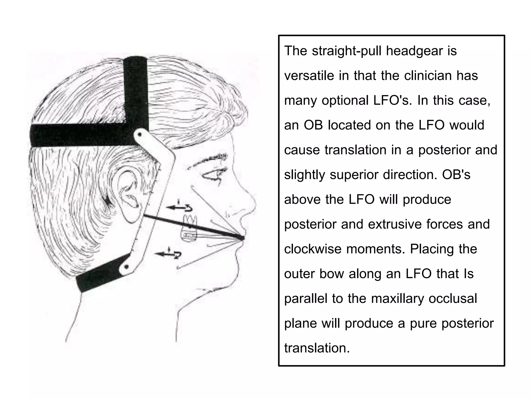 Biomechanics of Headgears | PPTX | Dental Health | Diseases and Conditions