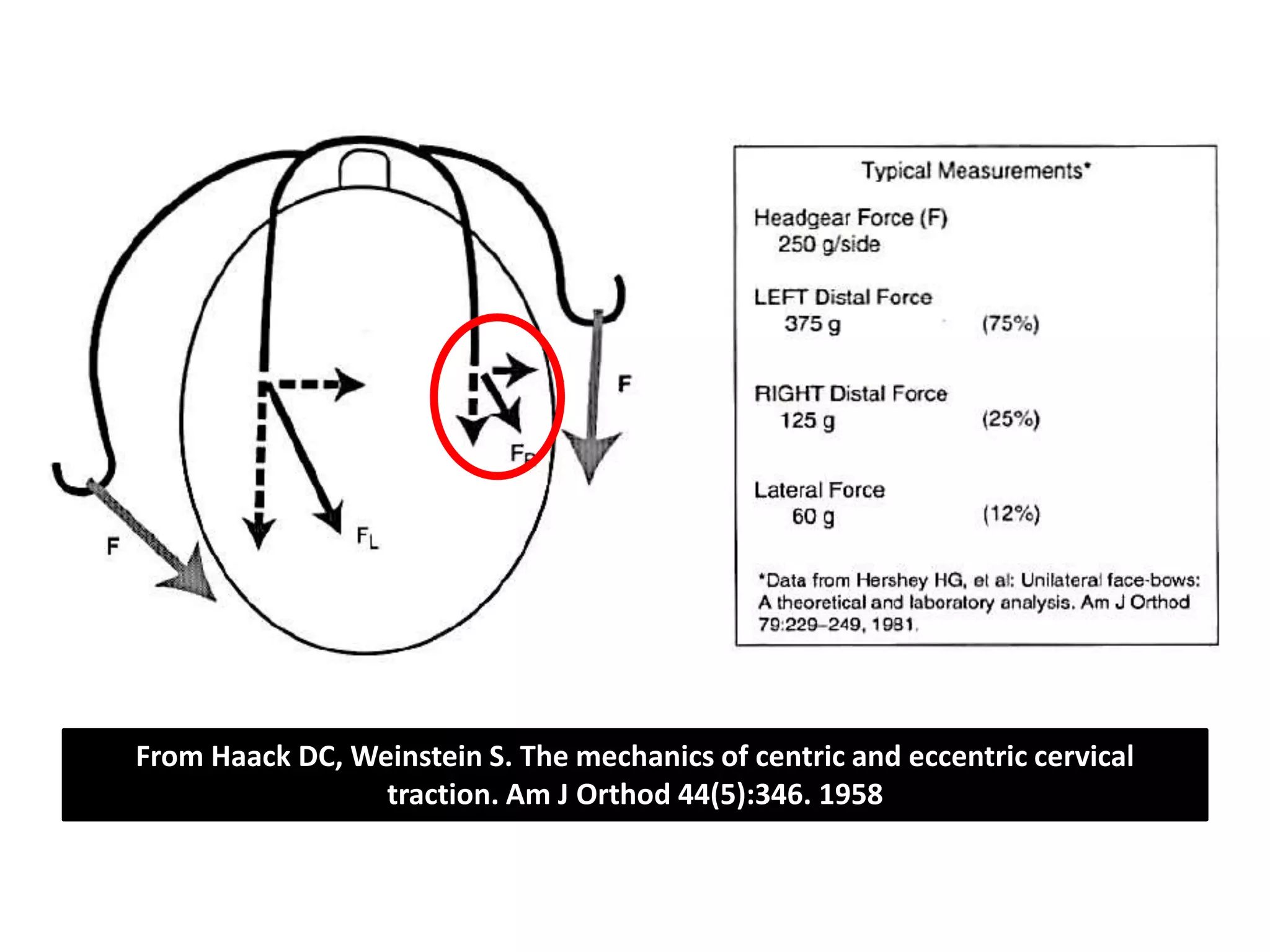Biomechanics of Headgears | PPTX