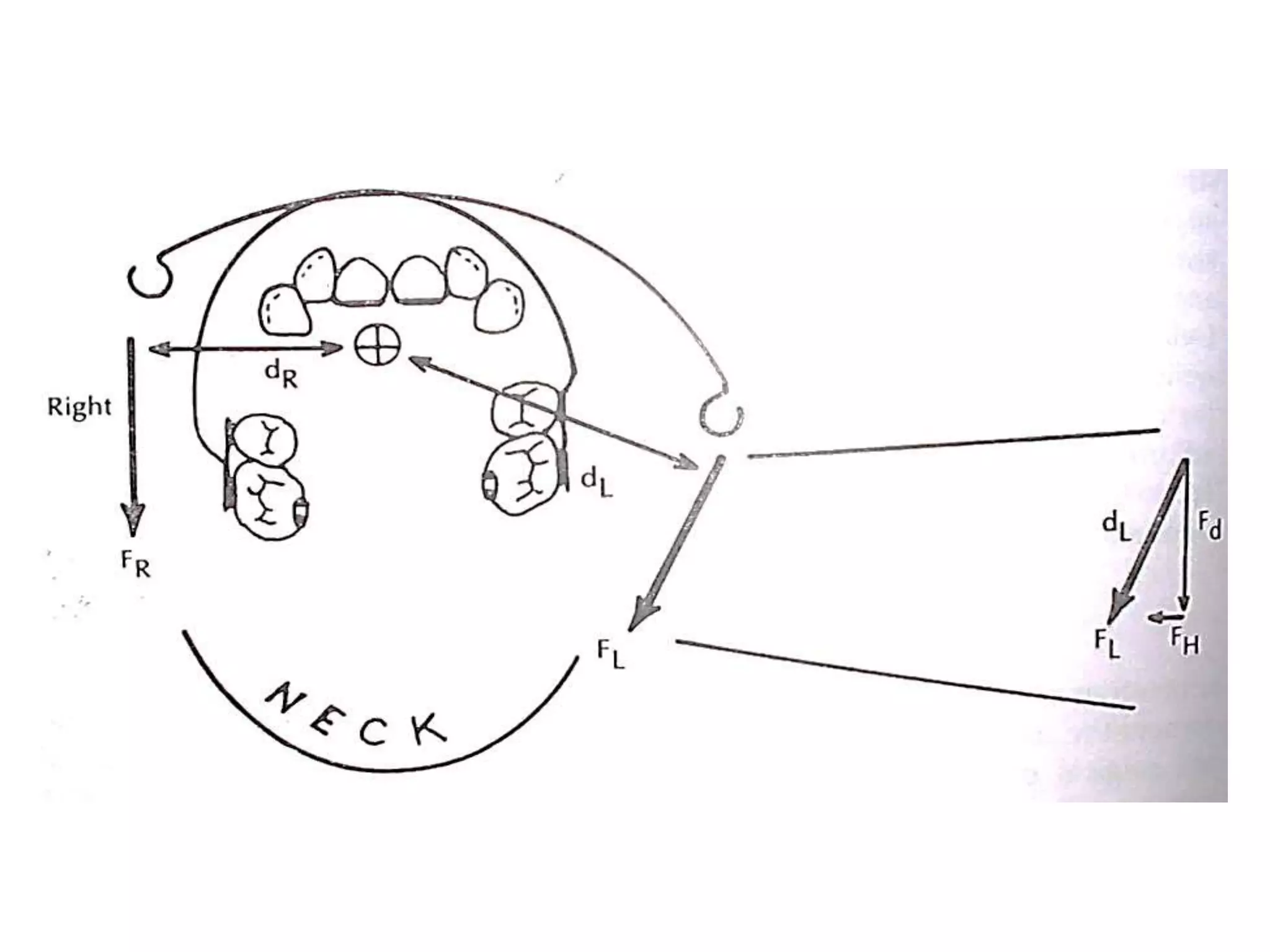 Biomechanics of Headgears | PPTX | Dental Health | Diseases and Conditions