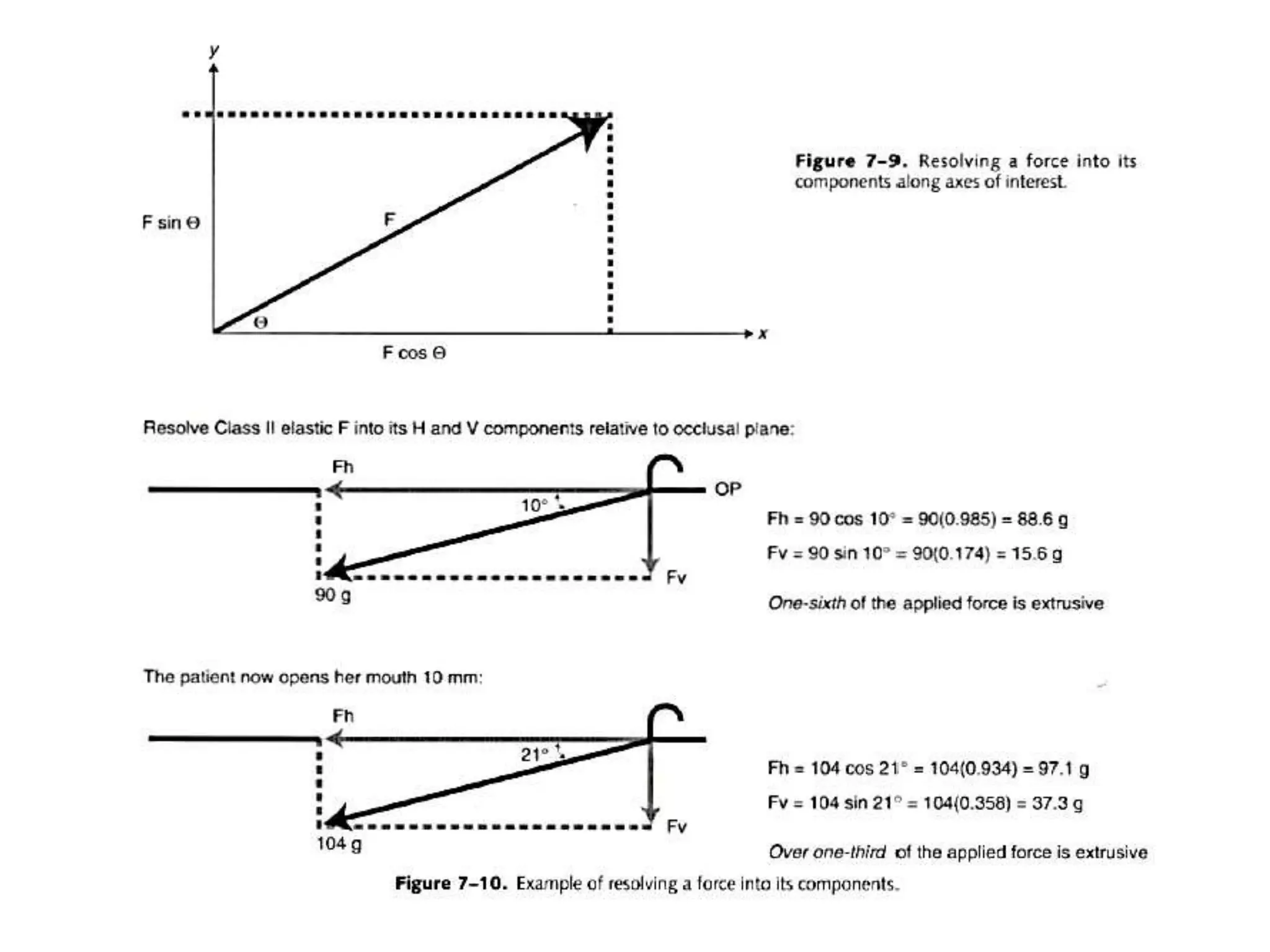 Biomechanics of Headgears | PPTX