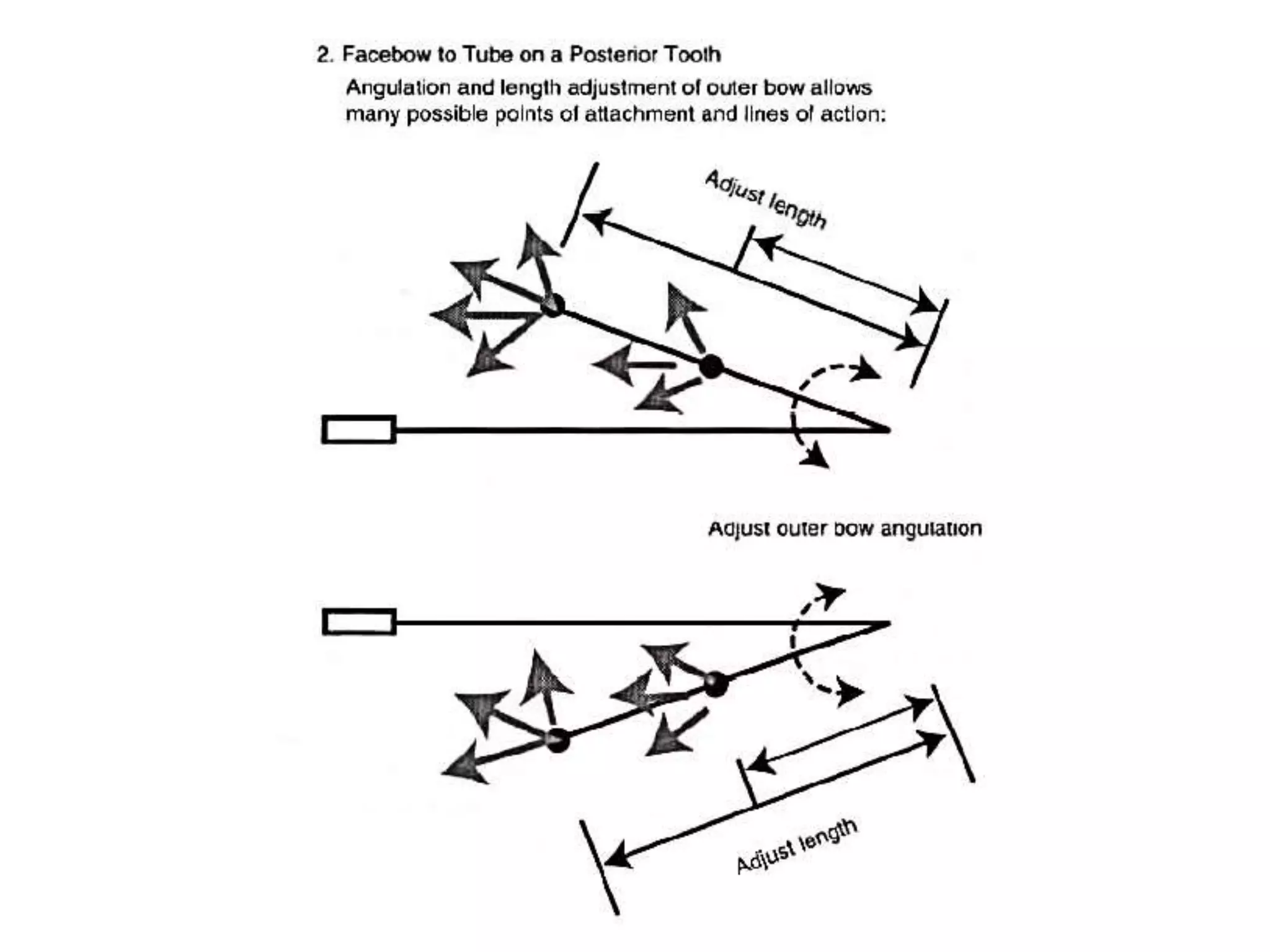 Biomechanics of Headgears | PPTX