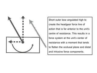 Biomechanics of Headgears | PPTX