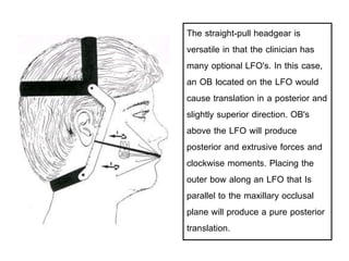 Biomechanics of Headgears | PPTX