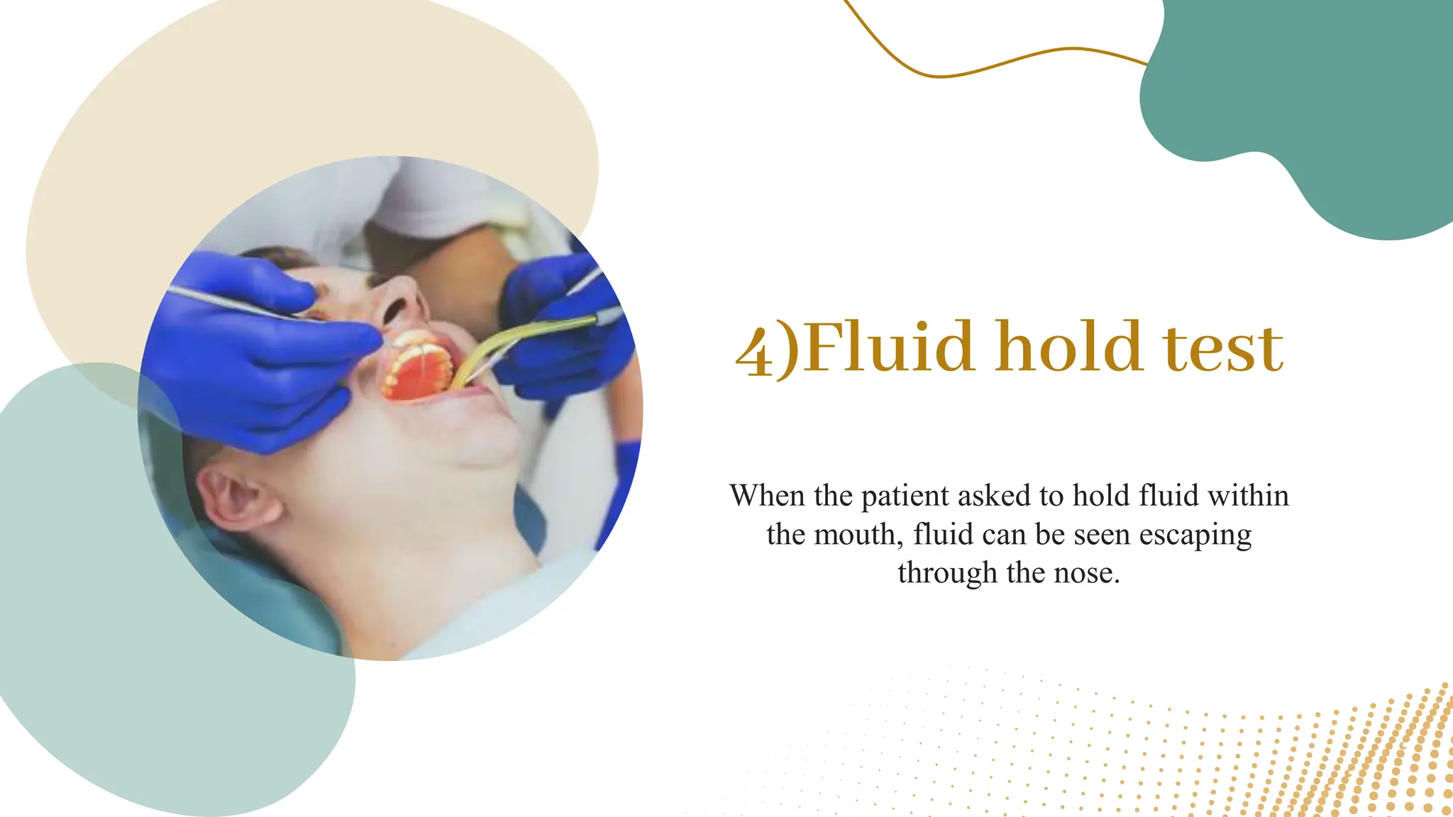 Discuss methods of investigation in case of oroantal fistula.pptx