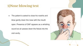 Discuss methods of investigation in case of oroantal fistula.pptx