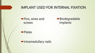 DISCUSS PRIN & ADVANCES OF INT FIXATION OF FRACTURES.pptx