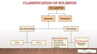 DISCUSS THE COMPLICATIONS OF SCLERITIS.pptx