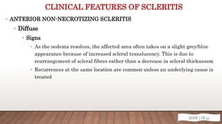 DISCUSS THE COMPLICATIONS OF SCLERITIS.pptx