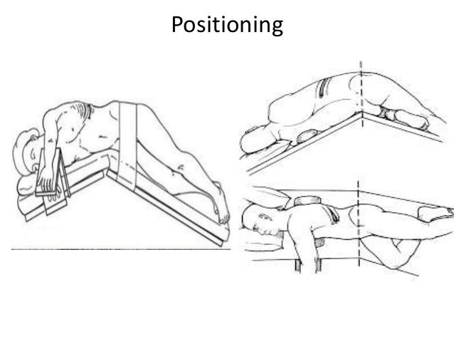 Discuss the operation of simple nephrectomy