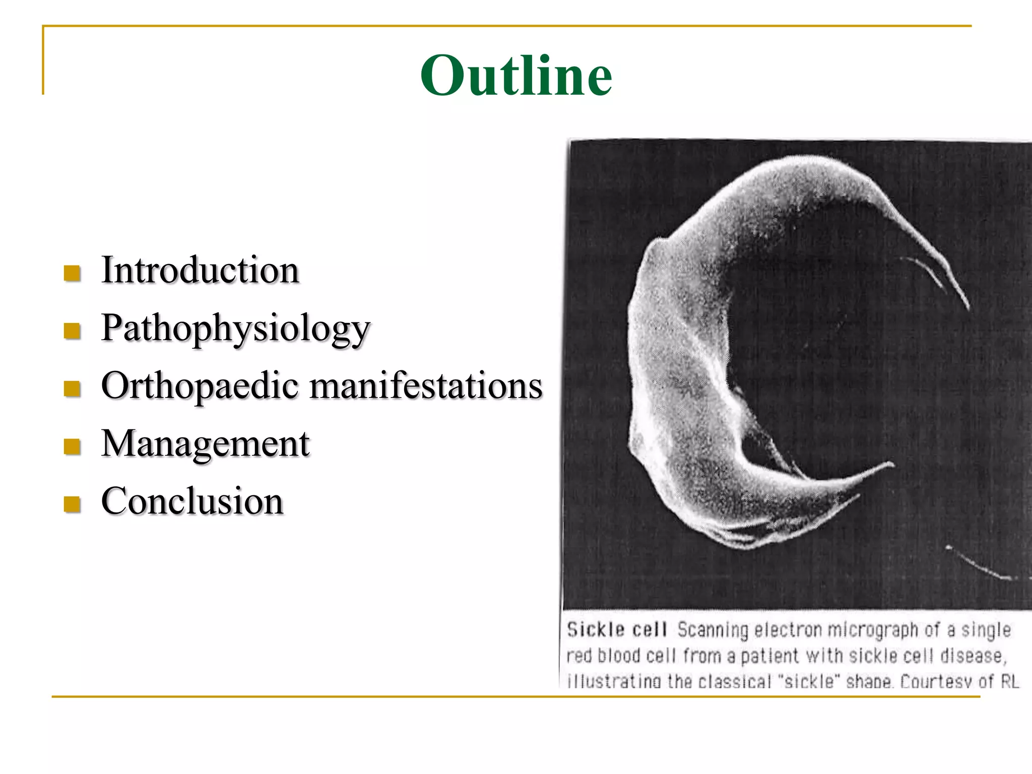 Discuss the orthopaedic manifestations of sickle cell disease | PPTX