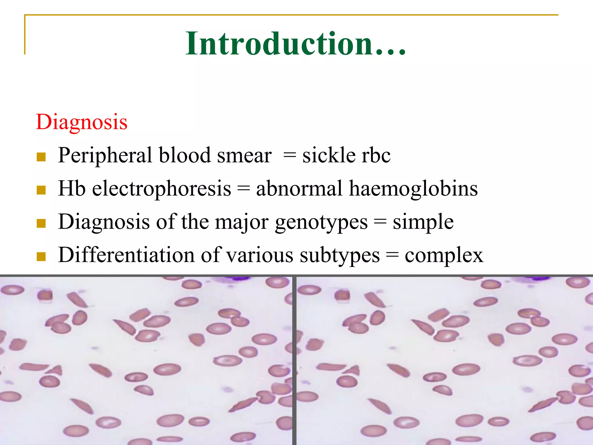 Discuss the orthopaedic manifestations of sickle cell disease | PPTX