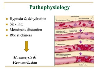 Discuss the orthopaedic manifestations of sickle cell disease | PPTX