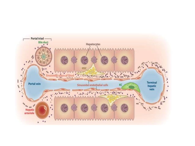 The pathogenesis of liver cirrhosis and fibrosis | PPTX