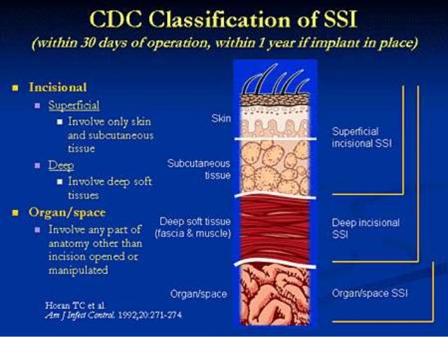 Discuss the prevention of post operative infection