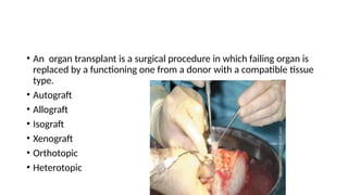 Discuss the Principle of Organ Transplant.pptx