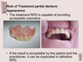 Discuss the role of rx partial denture/ dental implant courses | PPT