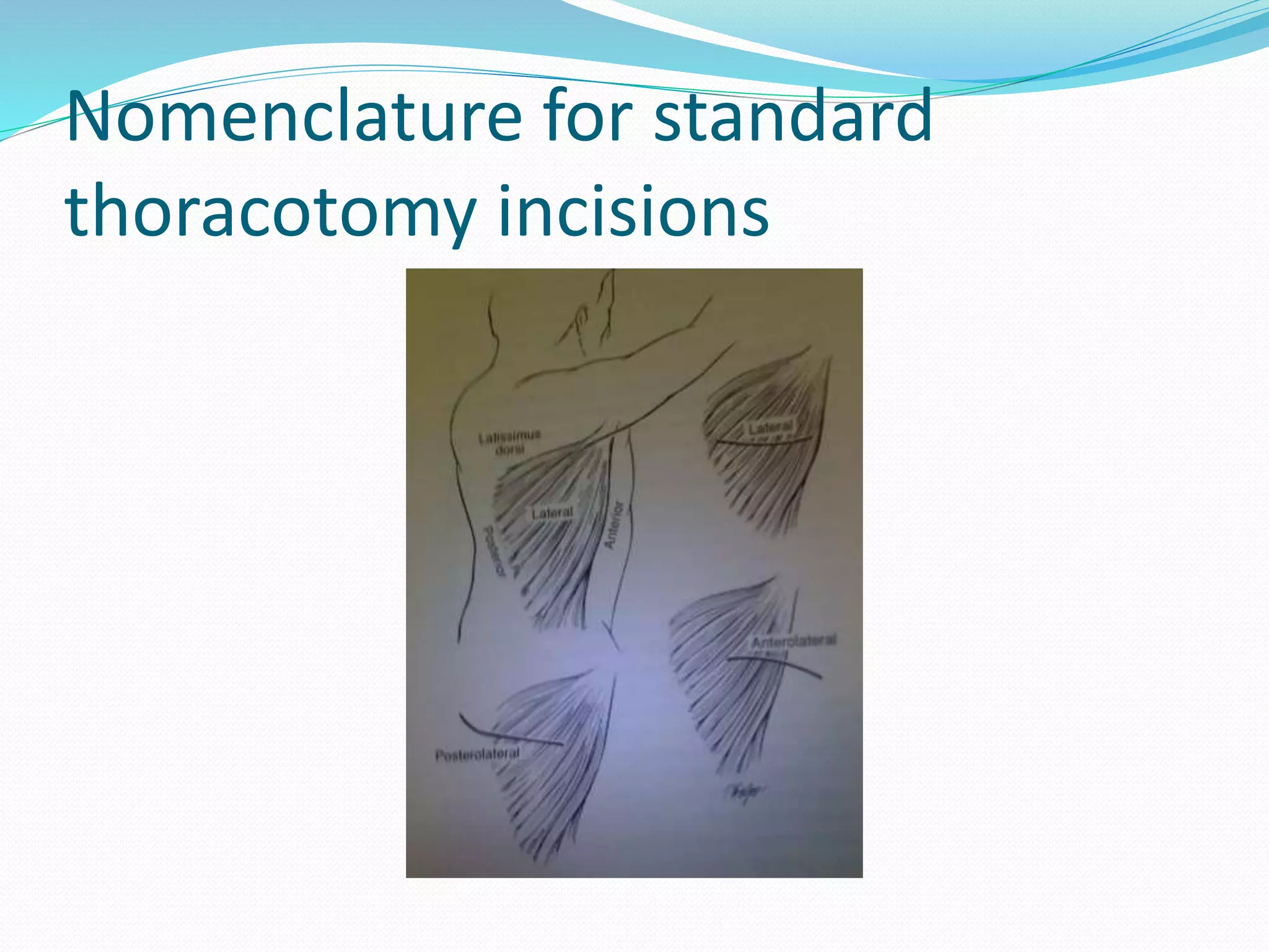 Discuss thoracic incisions(1) copy | PPTX