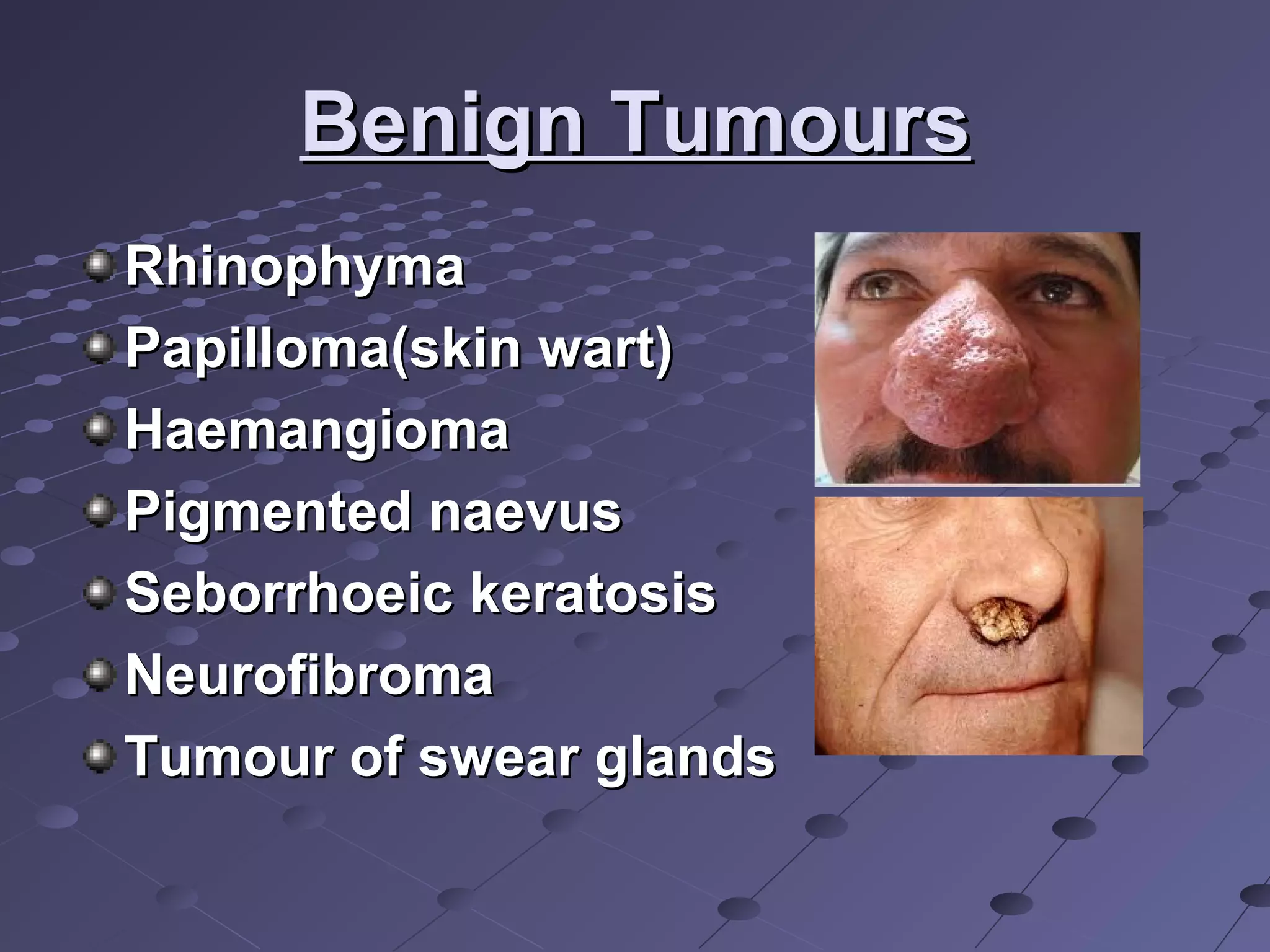 Diseases of external nose | PPT