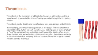 Disease-of-blood-vessel.pptx