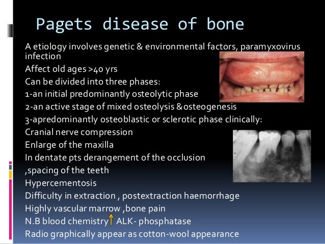Oral pathology - Disease of-jaw-bone