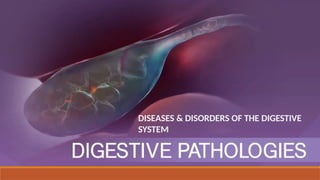 Diseases and disorders of the DIGESTIVE SYSTEM.pptx
