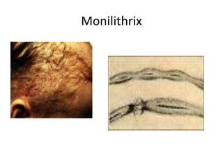 Disease and disorders of the hair and scalp | PPTX