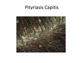 Disease and disorders of the hair and scalp | PPTX