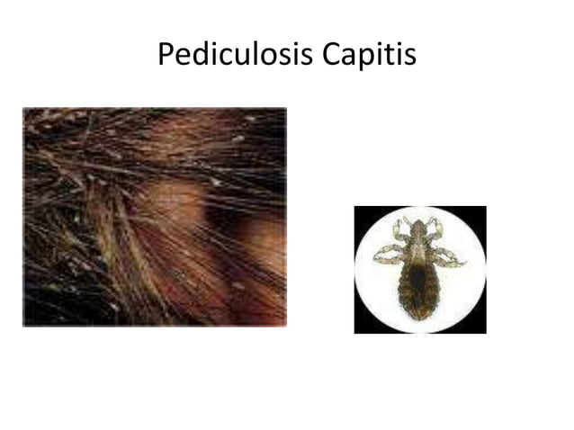 Disease and disorders of the hair and scalp | PPTX