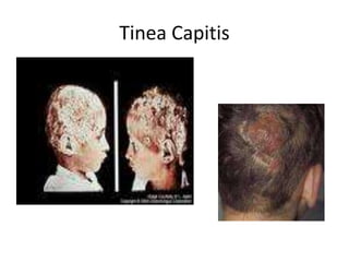 Disease and disorders of the hair and scalp | PPTX