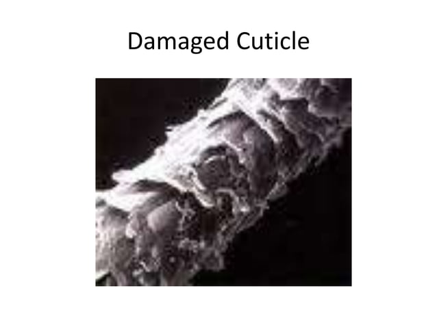 Disease and disorders of the hair and scalp | PPTX
