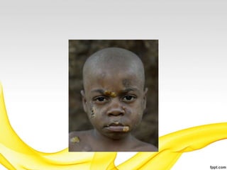 Disease for control elimination & eradication | PPTX