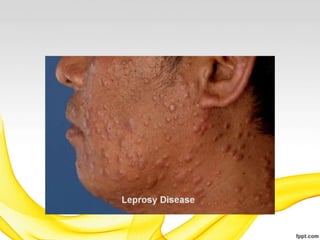 Disease for control elimination & eradication | PPTX