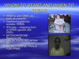 Disease modifying therapy in multiple sclerosis interferons | PPT