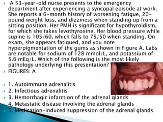 Disease of adrenal gland | PPTX