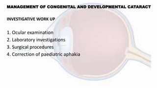 DISEASE OF CRYSTALLINE LENS, CATARACTpptx | PPTX